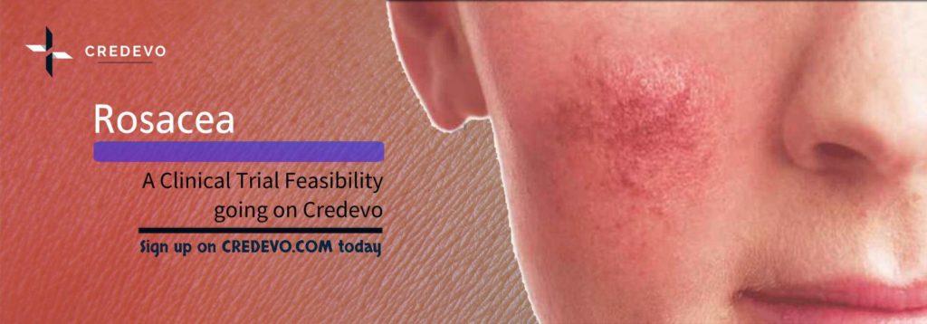 Rosacea - Clinical Trial Feasibility | Credevo Articles